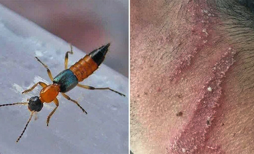 East surged with the Nairobi fly infection
